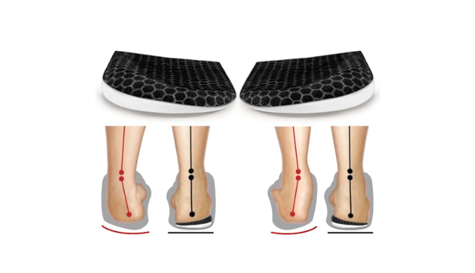 BIGGCOOL Corrective Insoles for Supination & Over-Pronation, Orthotics ...